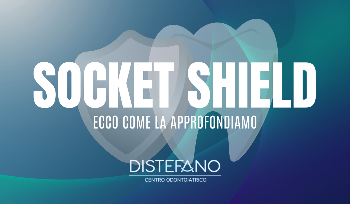 Socket Shield: la tecnica che rivoluziona l’implantologia